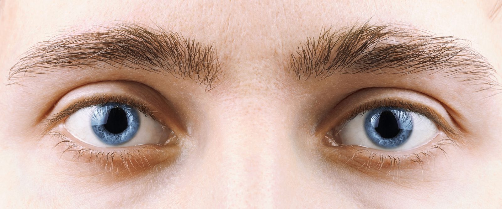 IPL (Intense Pulsed Light) therapy | Dry Eye | Optician